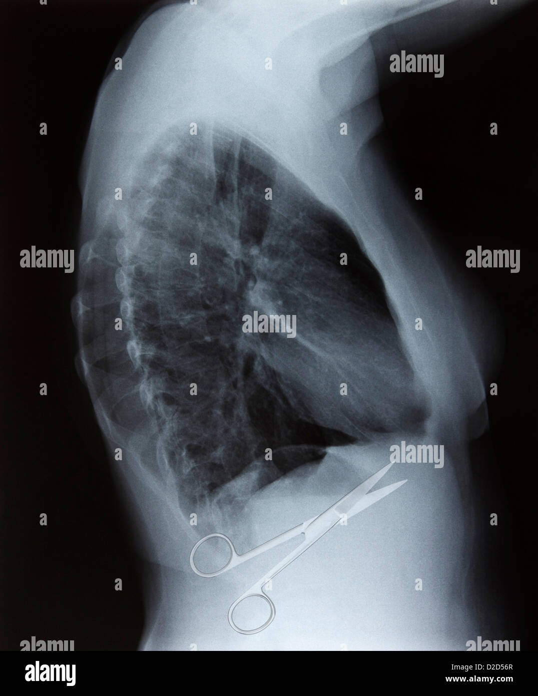 Surgical errors conceptual image Stock Photo - Alamy