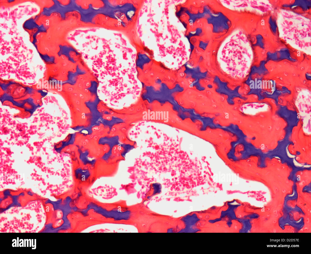 Developing bone light micrograph hi-res stock photography and images ...