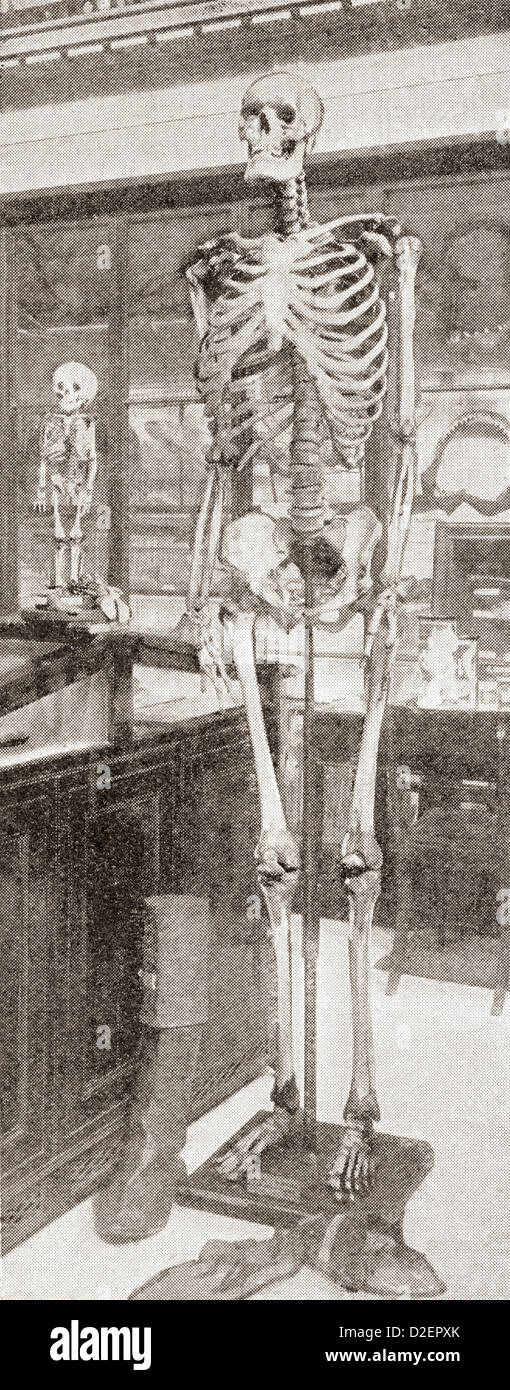 Irish giant skeleton skeleton hi-res stock photography and images - Alamy