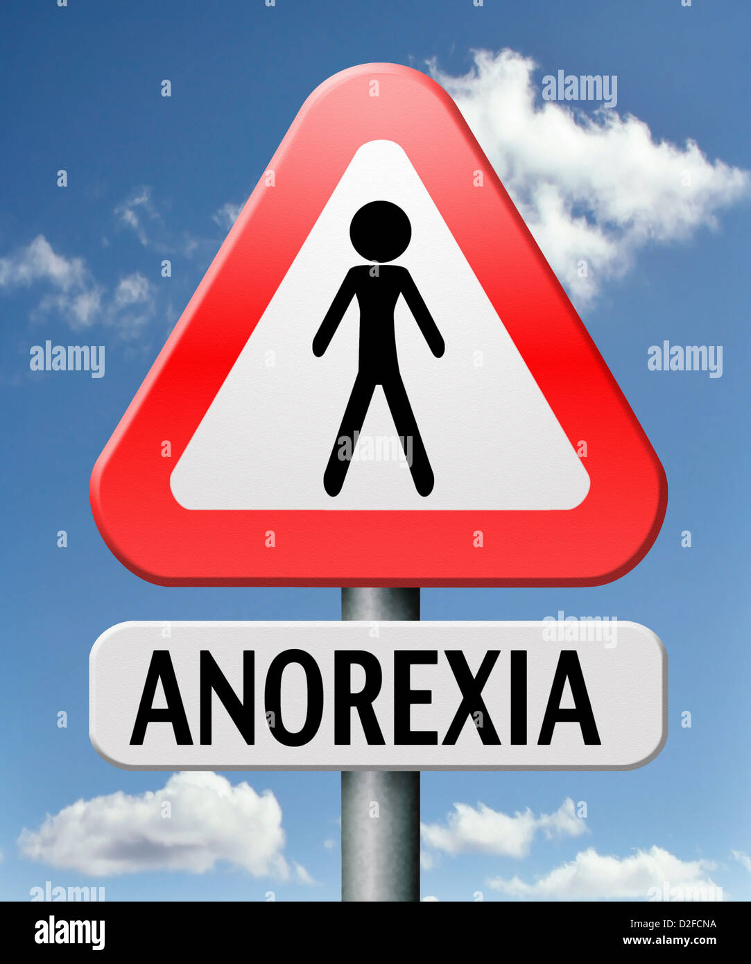 anorexia nervosa eating disorder prevention treatment symptoms and ...