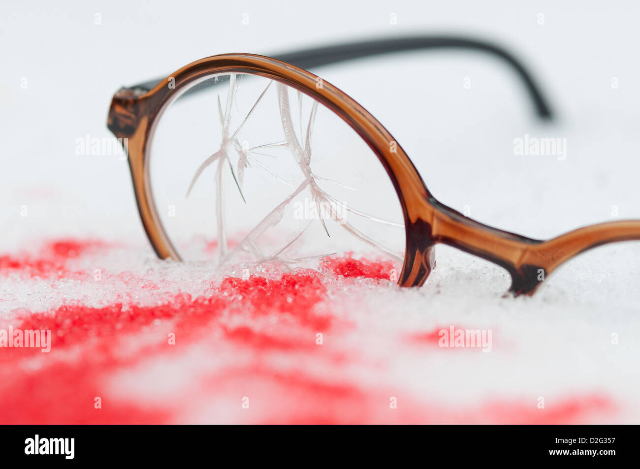 Pin Broken Bloody Glass Hand Injuries Caused By Glass | Northwestern