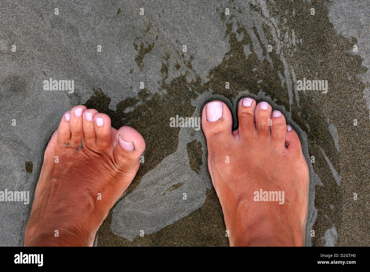 Sunburnt female leg on damp sand Stock Photo - Alamy