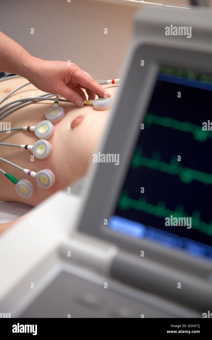 Essen, Germany, a patient is given a resting ECG Stock Photo - Alamy