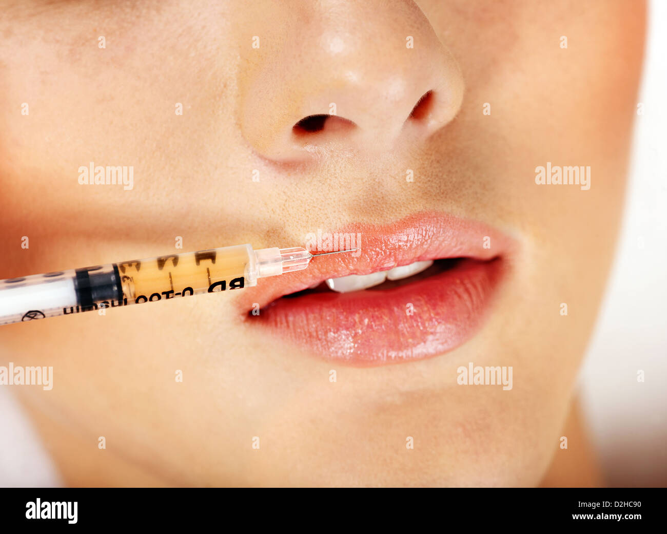 Beauty woman giving botox injections Stock Photo - Alamy