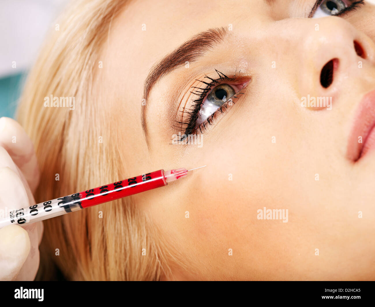 Botox injections hi-res stock photography and images - Alamy