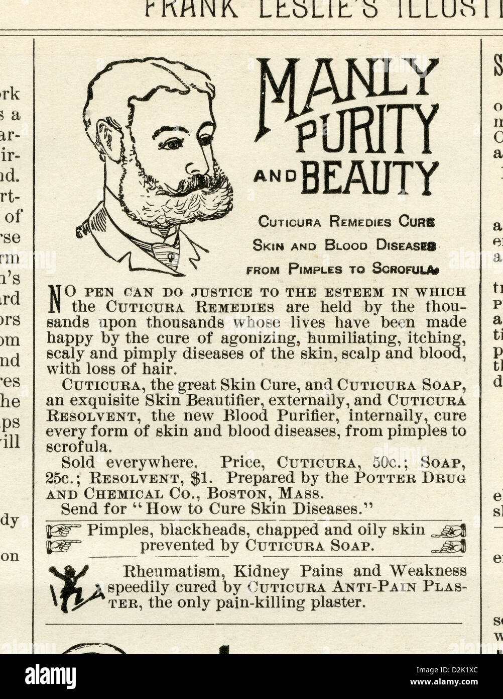 1890 advertisement, Cuticura Remedies Cure Skin and Blood Diseases from ...