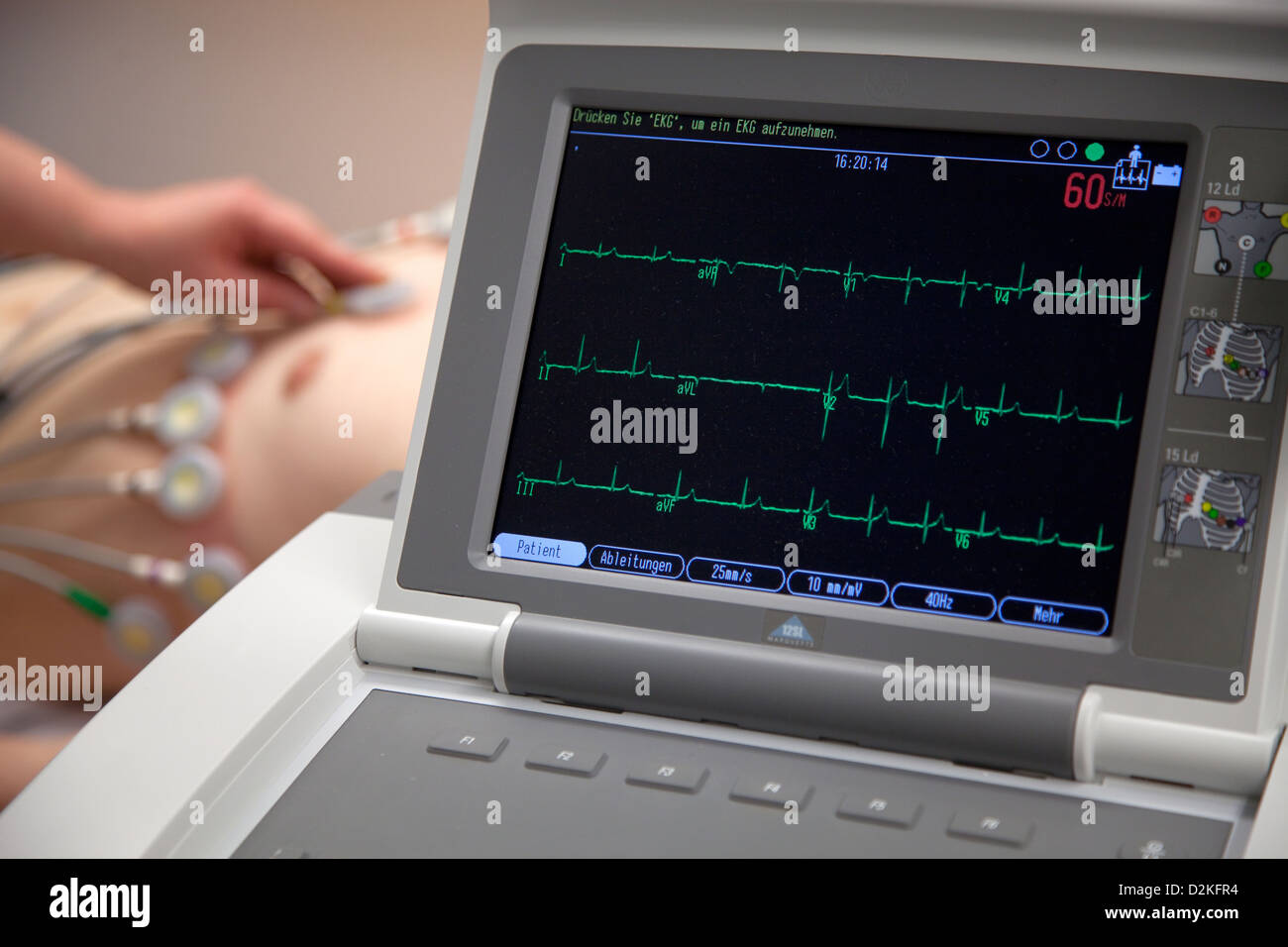 Essen, Germany, the heart rate curve of a patient with resting ECG ...