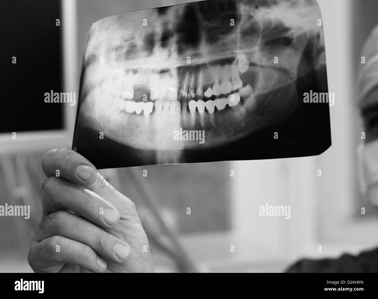 The doctor closely studying x-ray of human teeth Stock Photo - Alamy