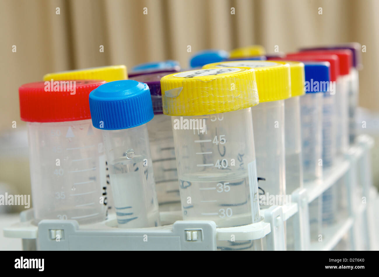 In vitro diagnostic test hi-res stock photography and images - Alamy