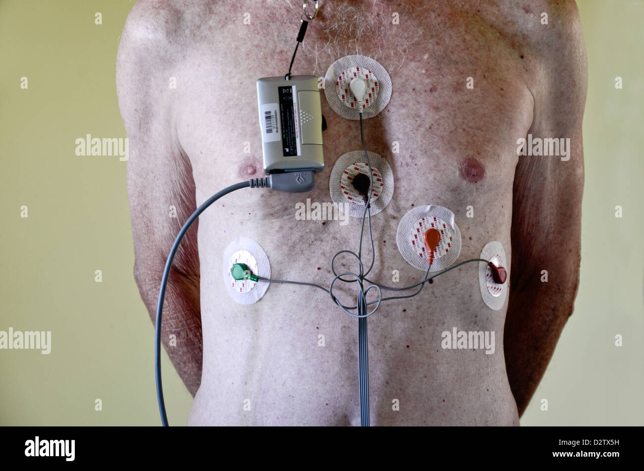 Man with Holter portable heart monitor Stock Photo - Alamy