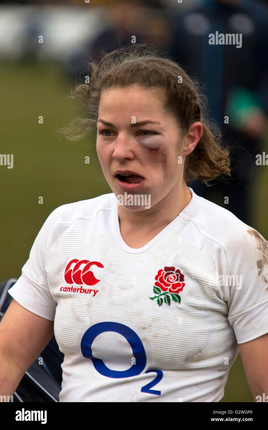 Emma Croker the England rugby hooker with a black eye 2.2.2013, Esher ...