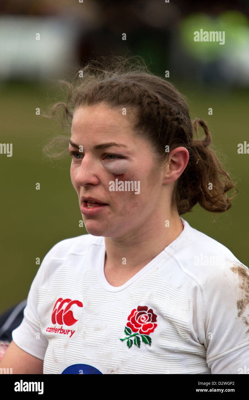 Emma Croker the England rugby hooker with a black eye 2.2.2013, Esher ...