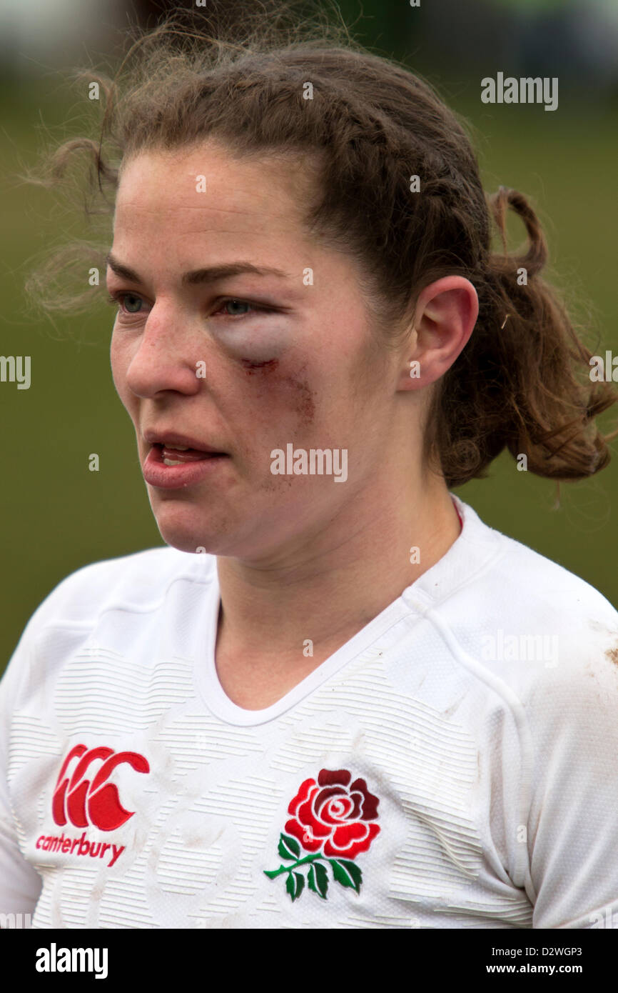 Emma Croker the England rugby hooker with a black eye 2.2.2013, Esher ...