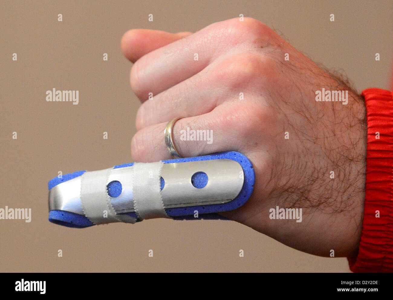 Match splint hi-res stock photography and images - Alamy