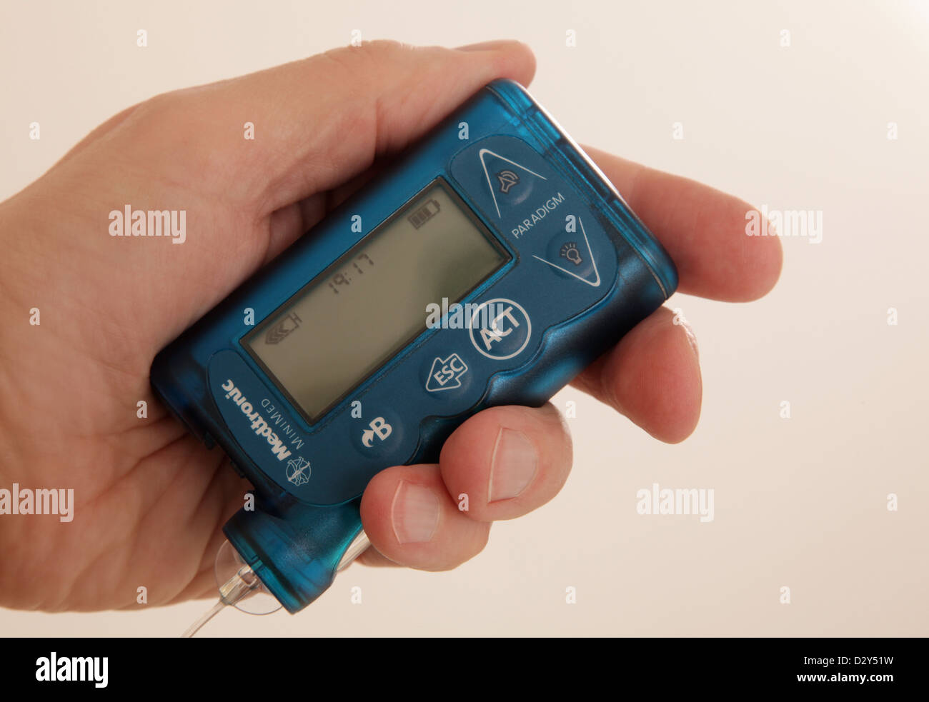 Insulin pump hi-res stock photography and images - Alamy