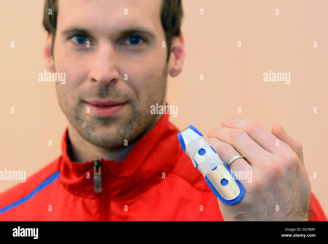 Match splint hi-res stock photography and images - Alamy