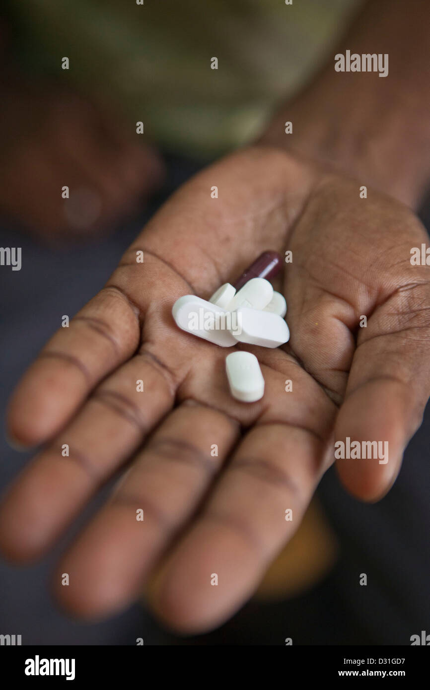 A patient holds their daily Tuberculosis (TB) medication in the palm of ...