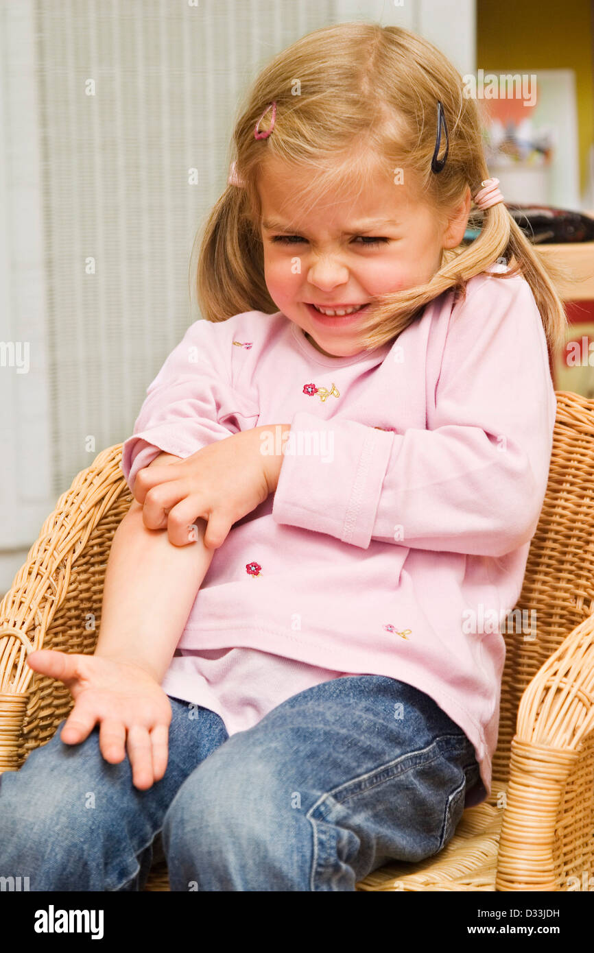 Neurodermatitis child hi-res stock photography and images - Alamy