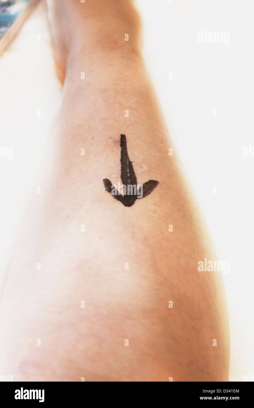 Surgeons Mark for Knee Operation On Womans Leg Stock Photo - Alamy