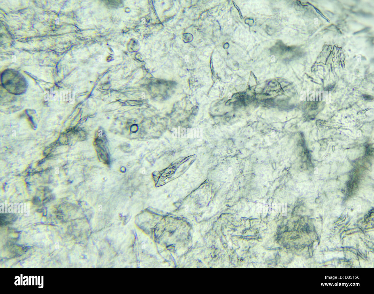 Skin under the microscope, background Stock Photo - Alamy