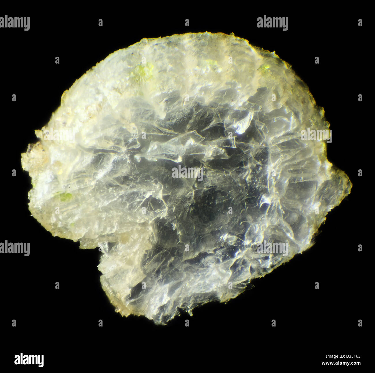 Needle hedgehog under the microscope (Erinaceus europaeus Stock Photo ...