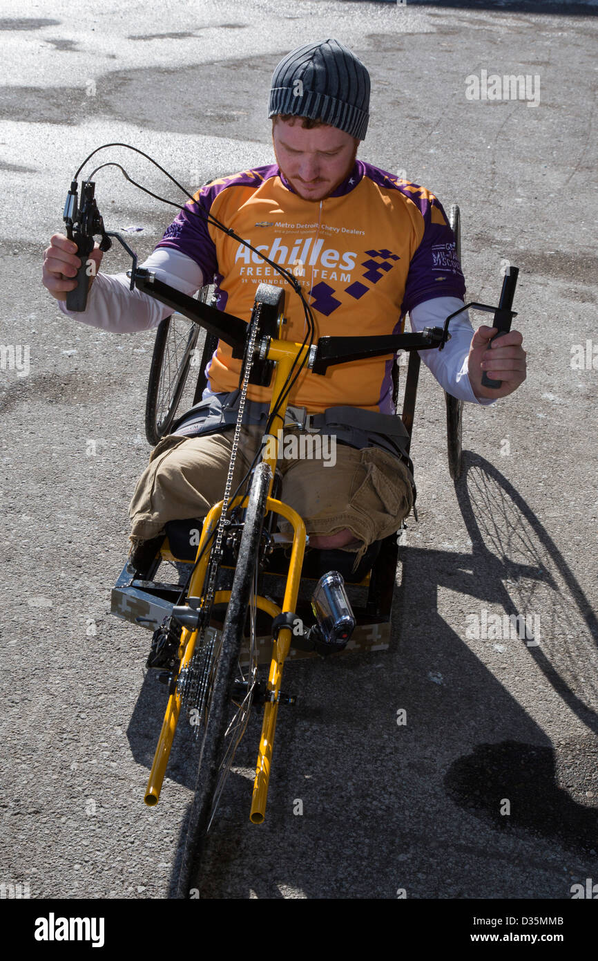 Hand amputee hi-res stock photography and images - Alamy