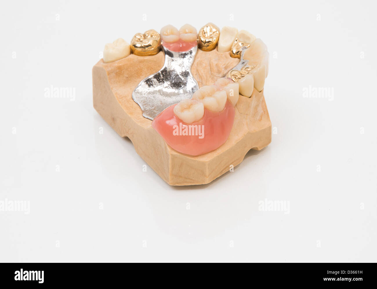 Gold Teeth High Resolution Stock Photography and Images - Alamy