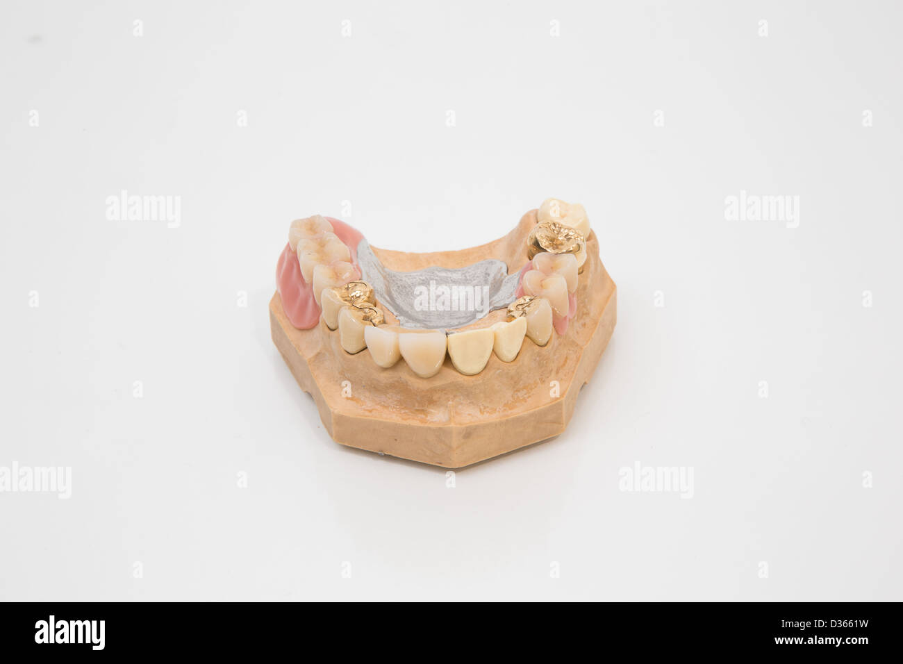 Gold Teeth High Resolution Stock Photography and Images - Alamy