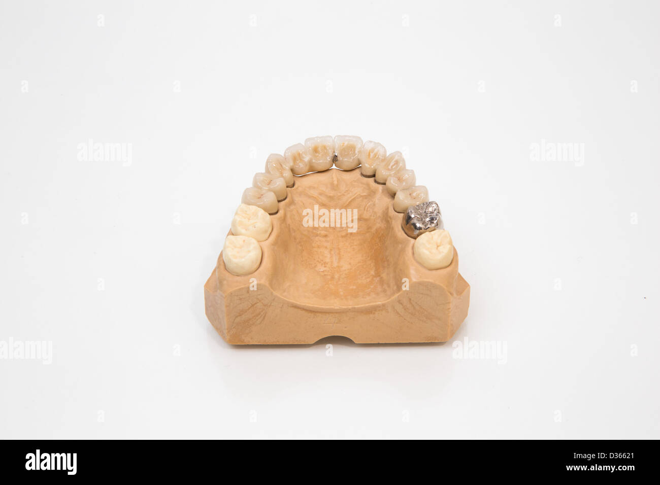 Gold teeth tooth hi-res stock photography and images - Alamy