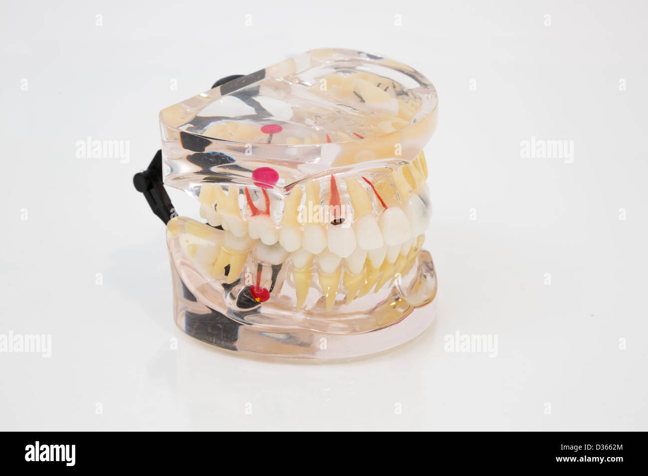 Human denture hi-res stock photography and images - Alamy