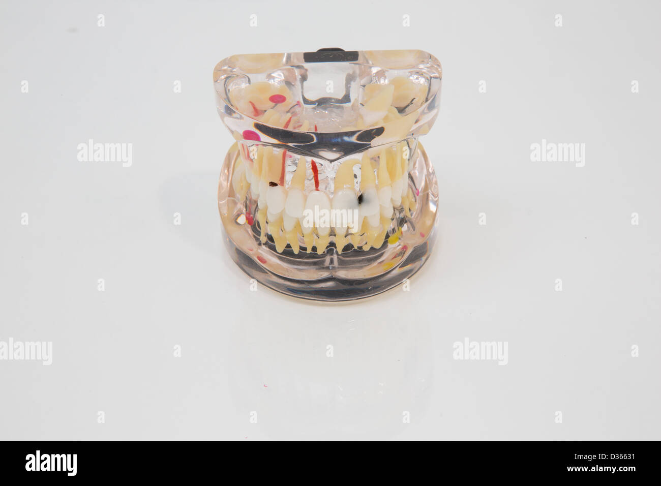 Human denture hi-res stock photography and images - Alamy