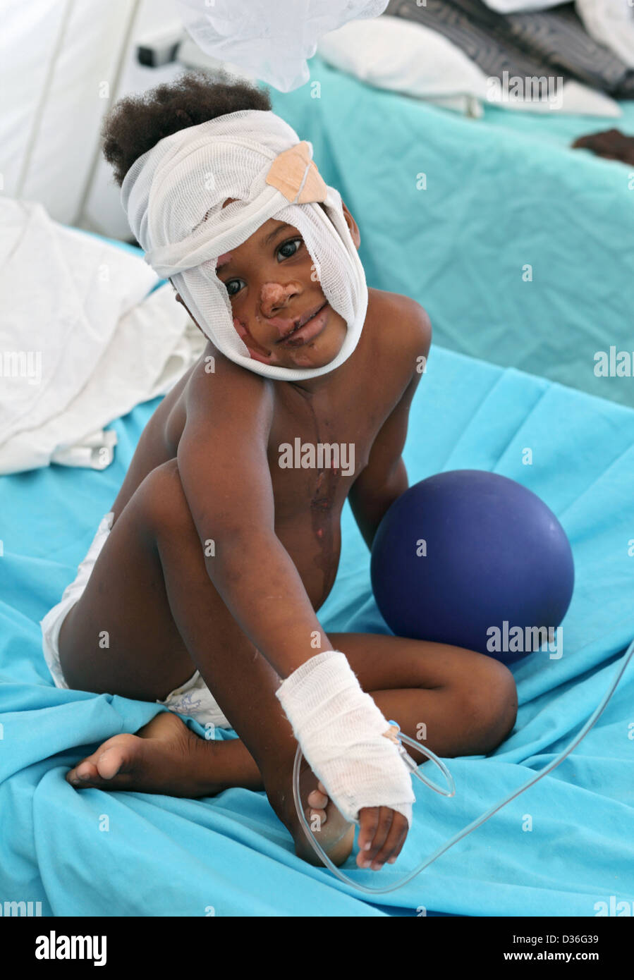 Carrefour Haiti a child with a burn injury patients in tent Stock Photo Alamy