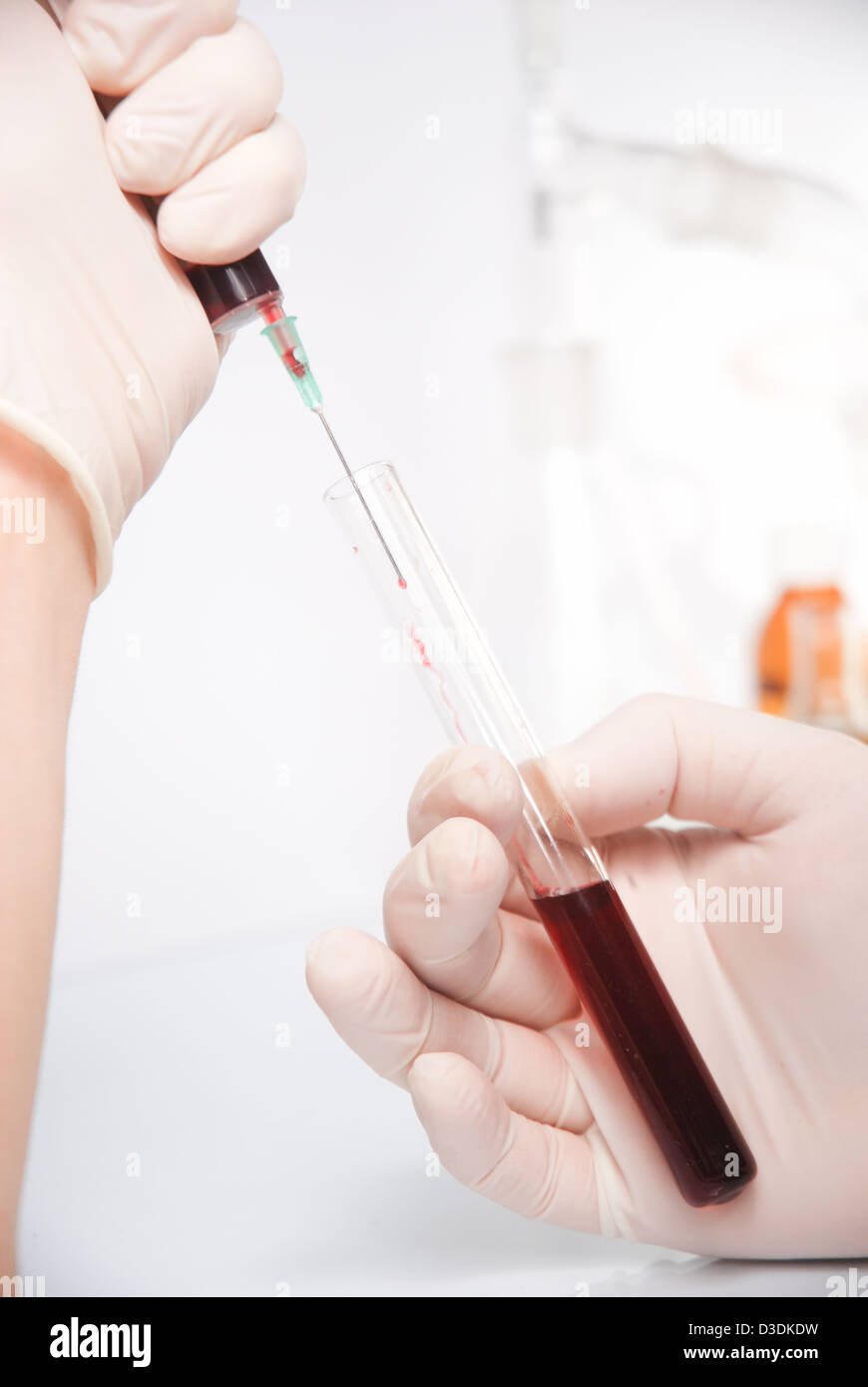 Doctor's hand in glove with blood in laboratory Stock Photo - Alamy