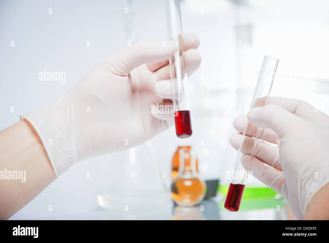 Doctor's hand in glove with blood in laboratory Stock Photo - Alamy