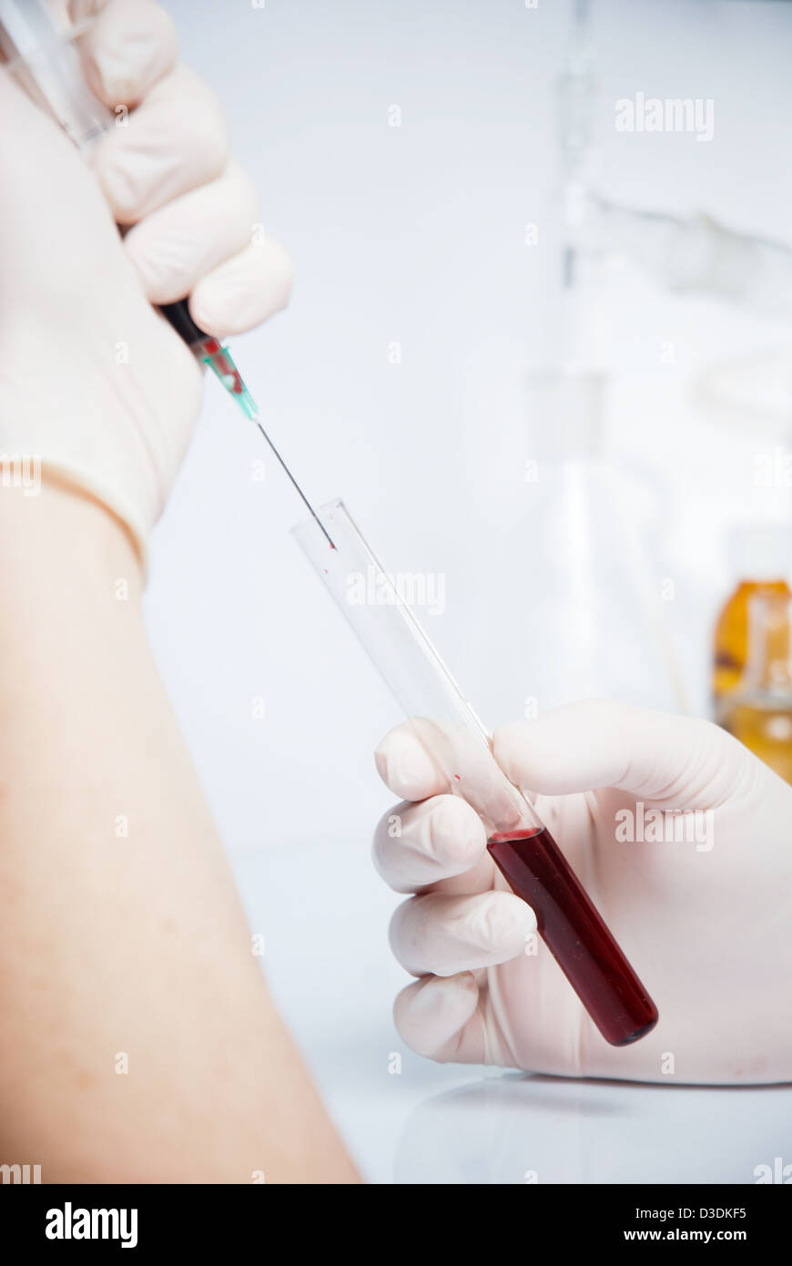 doctor taking some blood samples, using pipette and small test tube ...