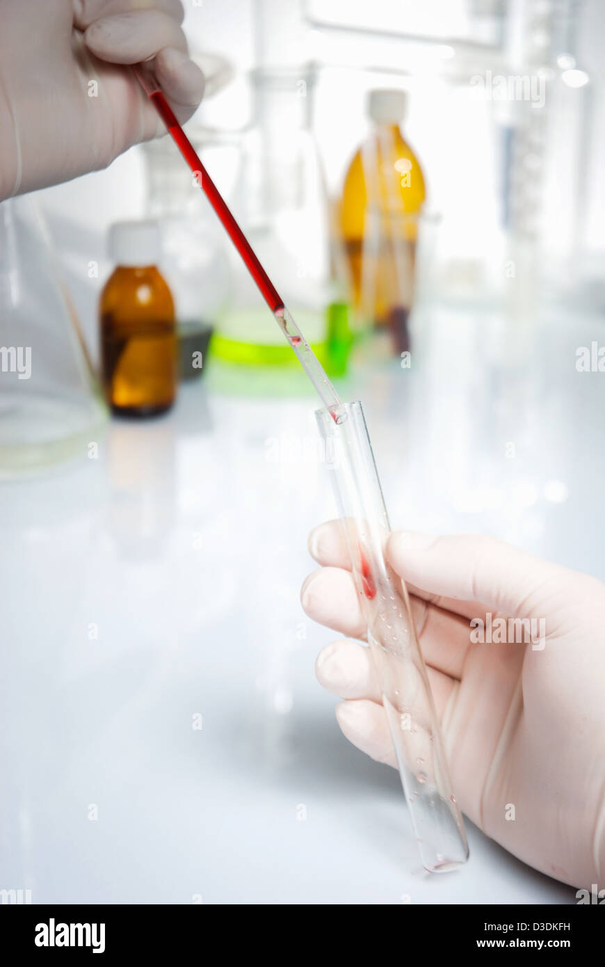 Doctor's hand in glove with blood in laboratory Stock Photo - Alamy