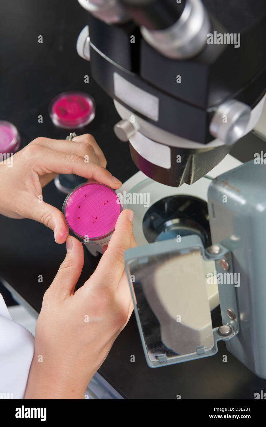 Bacterial culture hi-res stock photography and images - Alamy