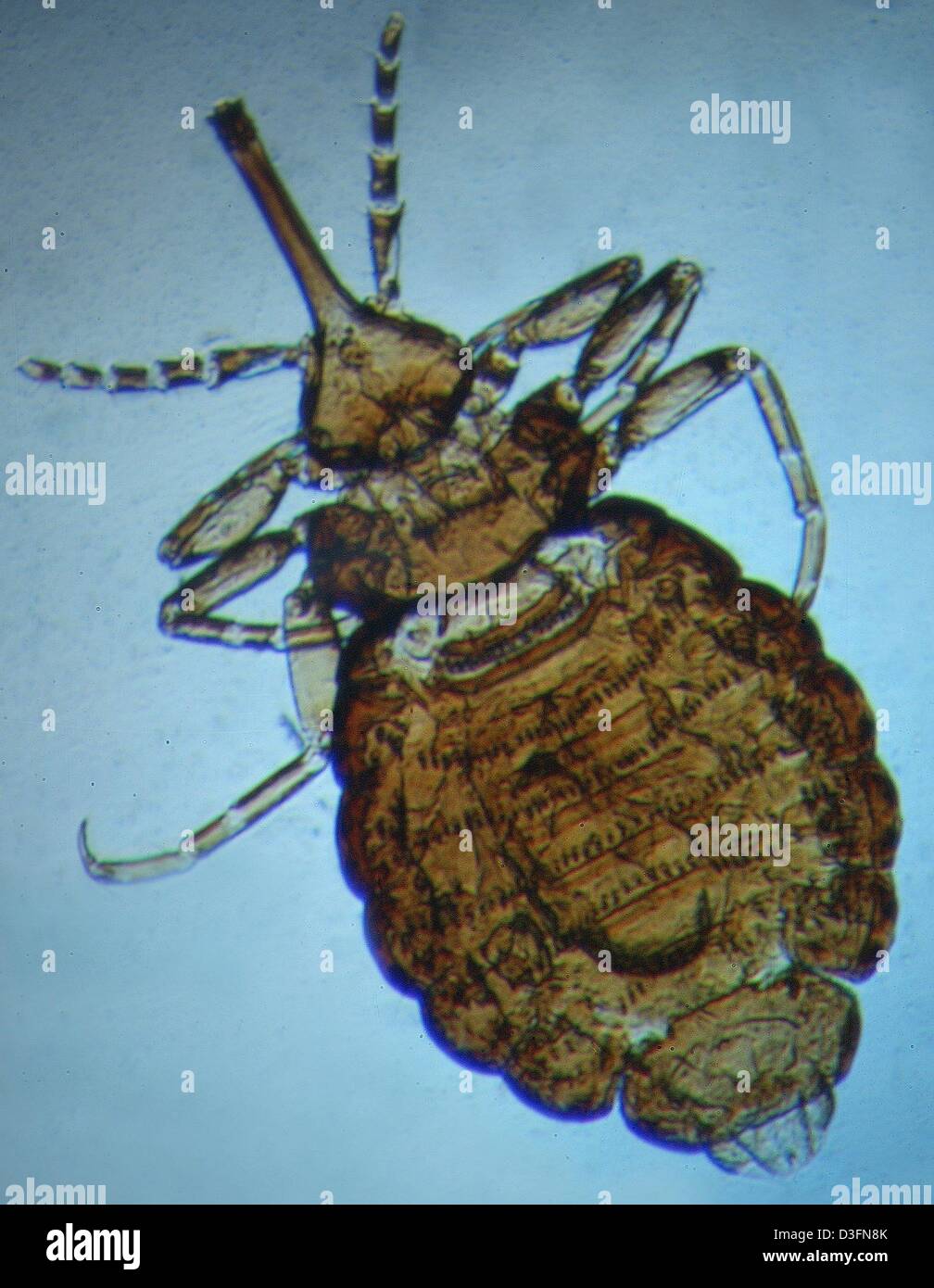 (dpa) - View of a microscopic compound of a female Haematomyzus ...