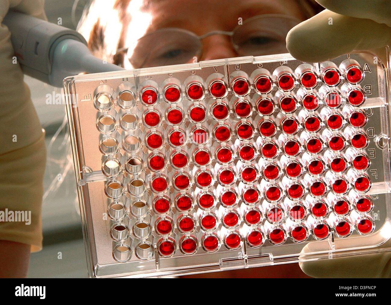 (dpa) - Laboratory worker Heiwidis Friedrich prepares a pallette of ...