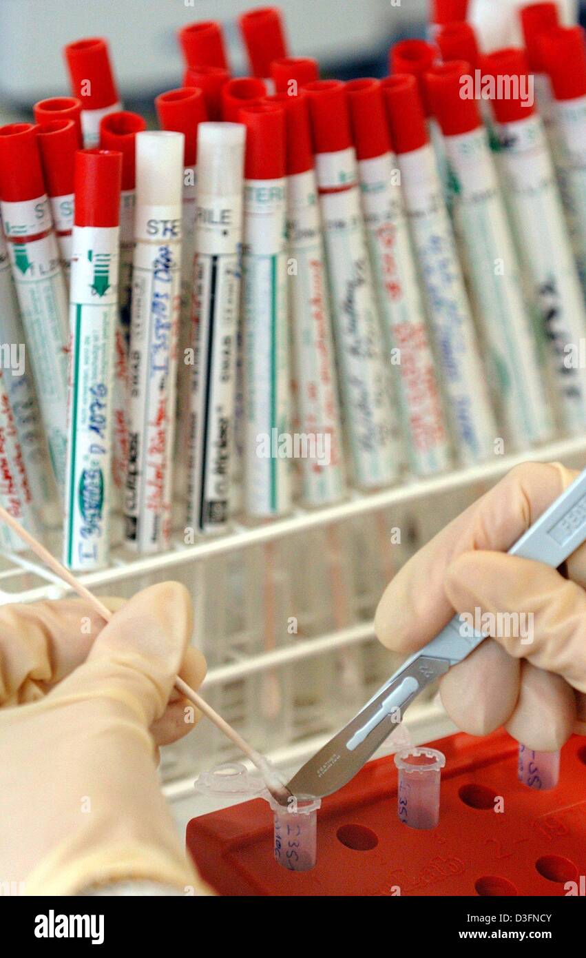 (dpa) - An employee of a DNA laboratory takes a sample of blood traces ...