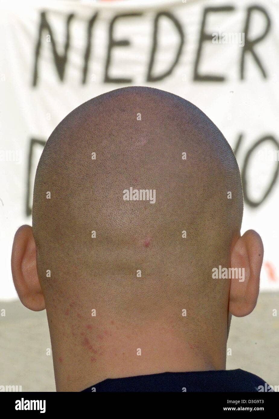 (dpa) - A skinhead is seen from behind as he participates in a Neo Nazi ...