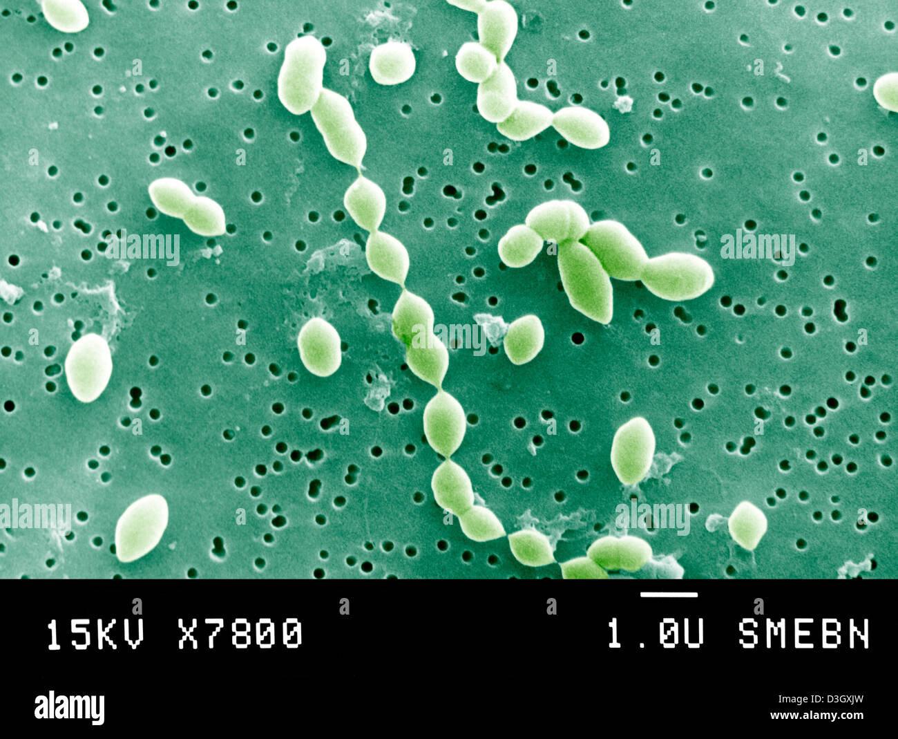 Streptococcus Pneumoniae Microscope High Resolution Stock Photography ...