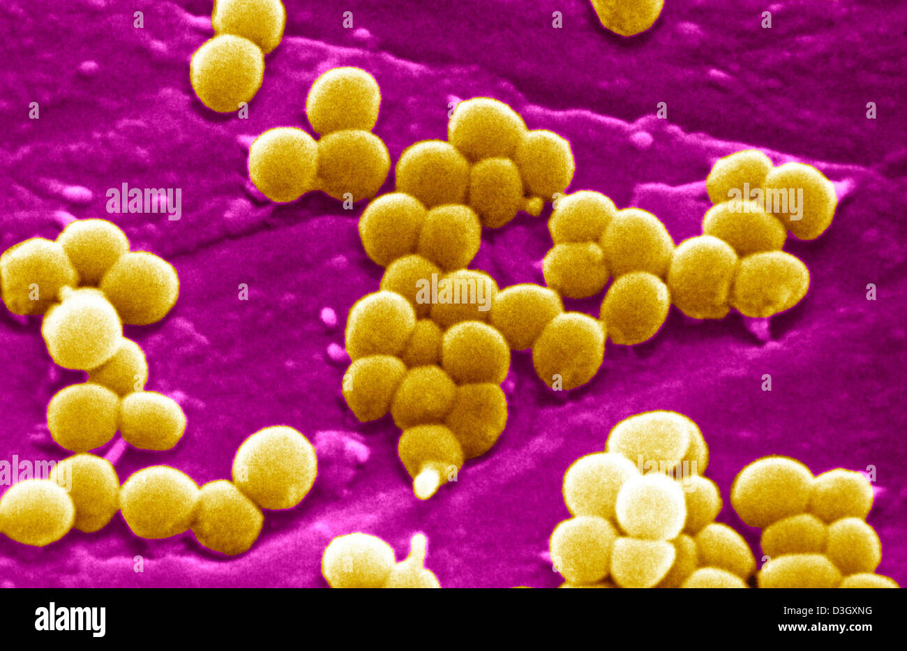 STAPHYLOCOCCUS AUREUS SEM Stock Photo - Alamy