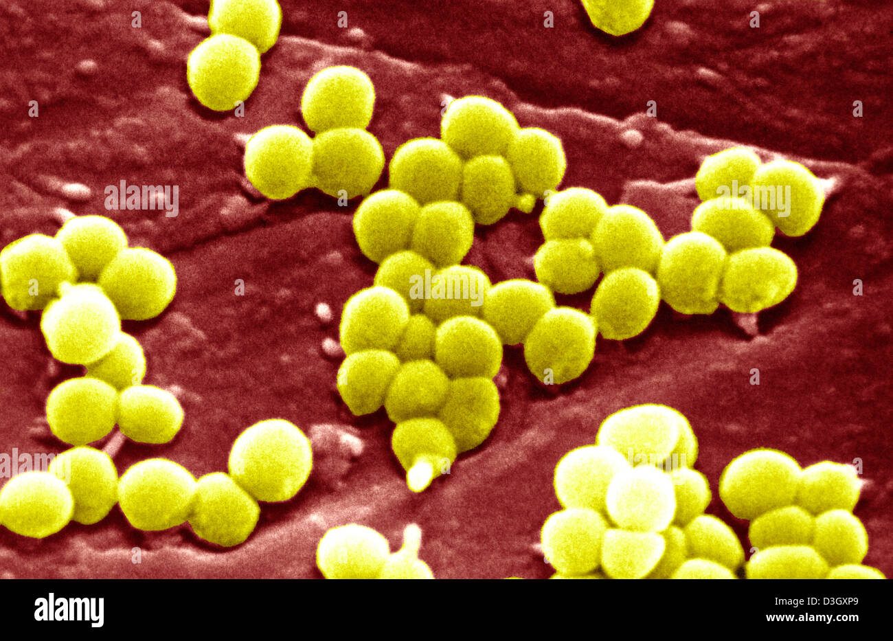 STAPHYLOCOCCUS AUREUS SEM Stock Photo - Alamy