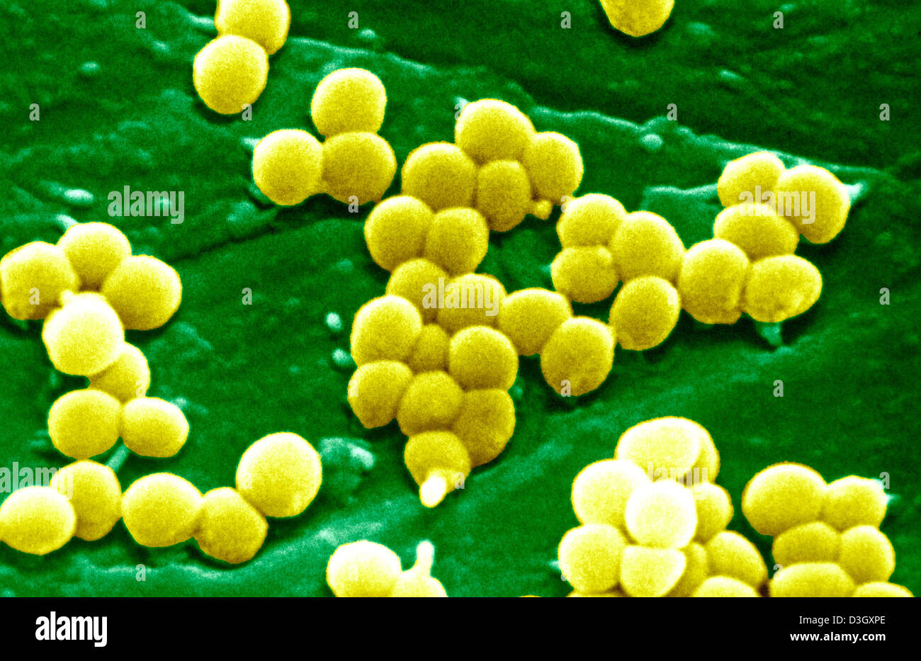 STAPHYLOCOCCUS AUREUS SEM Stock Photo - Alamy STAPHYLOCOCCUS AUREUS SEM Stock Photo - Alamy