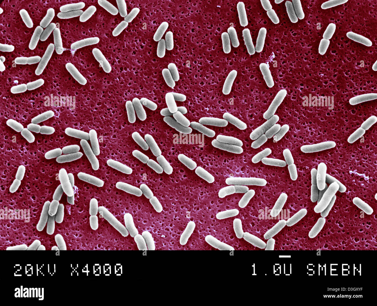 Scanning electron microscope e coli hi-res stock photography and images ...