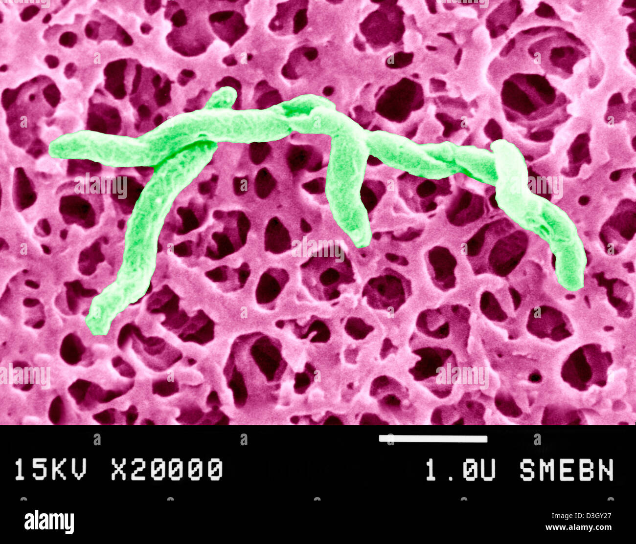 Campylobacter jejuni bacteria hi-res stock photography and images - Alamy