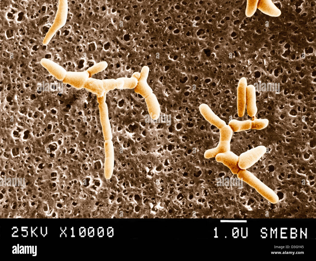 Listeria Bacteria Stock Photos & Listeria Bacteria Stock Images - Alamy