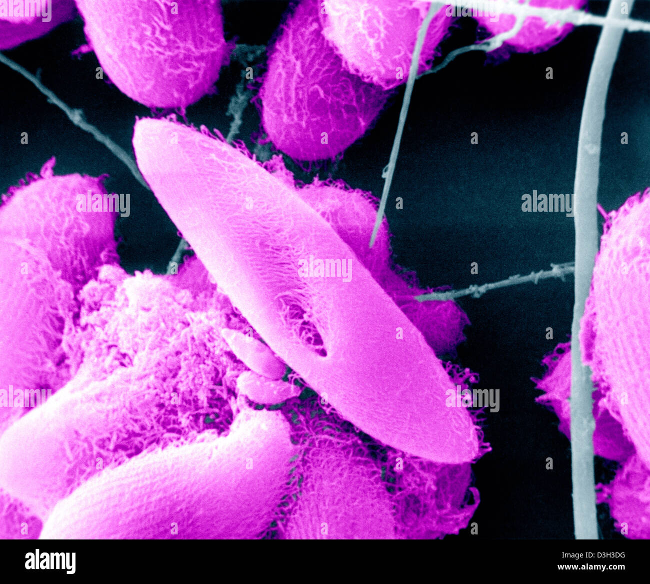 Paramecium sp protozoan sem hi-res stock photography and images - Alamy