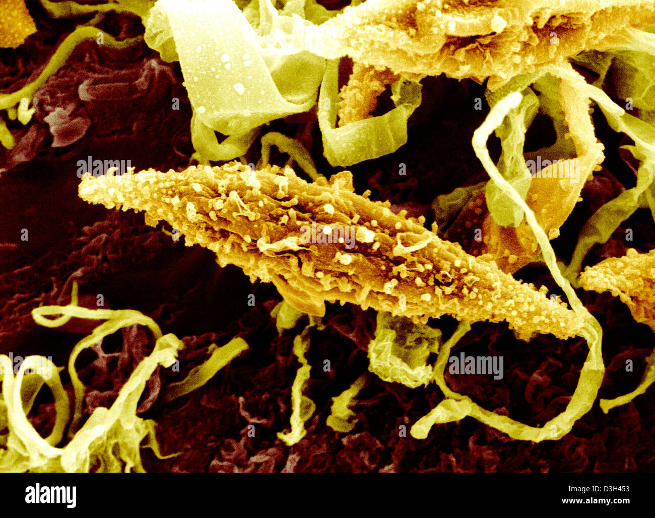 Dermatophyte scalp hi-res stock photography and images - Alamy